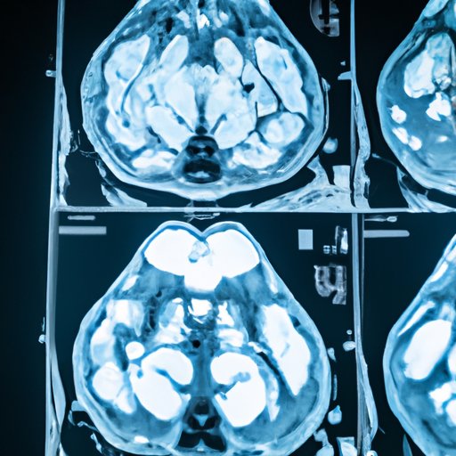 What is a CT Scan and How Does it Work? - The Enlightened Mindset