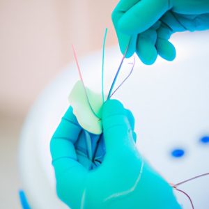 Exploring How Does Dissolving Stitches Work: A Comprehensive Guide ...