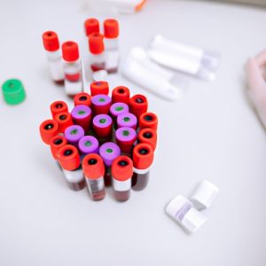 How to Collect Blood Cultures: Step-by-Step Instructions and Tips for ...