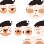 Describing Tired Eyes in Writing: Drooping Eyelids, Hazy Gaze, and More ...