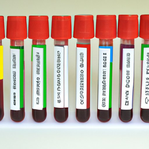 The Significance of Color Coded Tubes in Blood Culturing - The ...