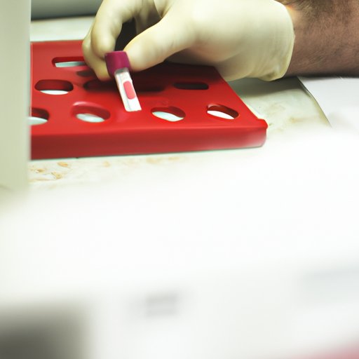 What is a Blood Culture Test? Benefits, Risks and Steps Involved - The ...