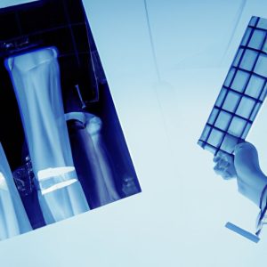 Who Discovered X-Ray Technology? A Look at Wilhelm Roentgen’s Life and ...