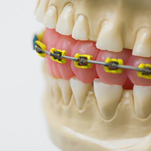 Who Invented Braces? Exploring the Pioneers of Orthodontics - The ...